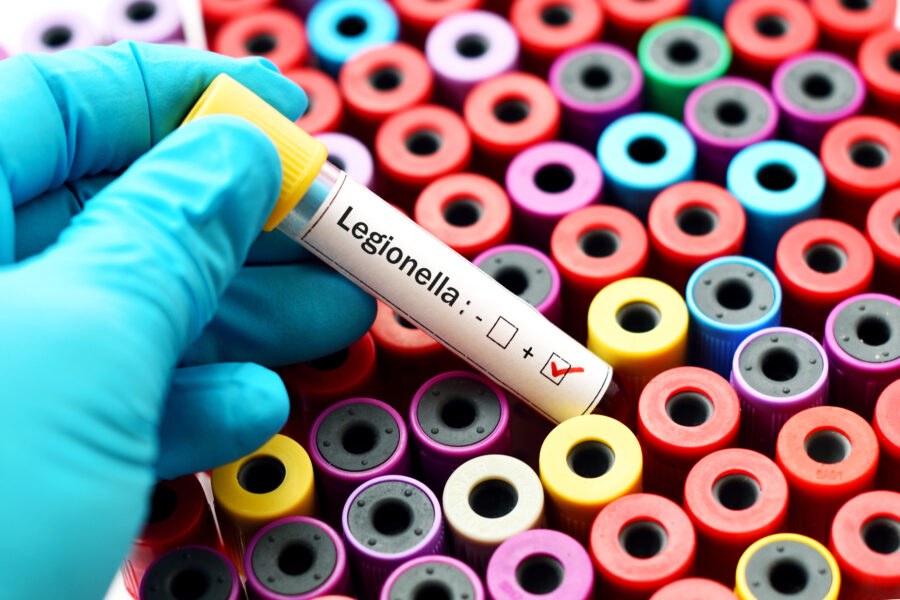 Legionella Risk Management in Building Water Systems | TRC